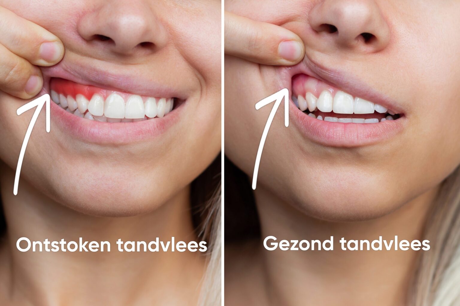 Kaakpijn: 5 oorzaken en behandelmogelijkheden